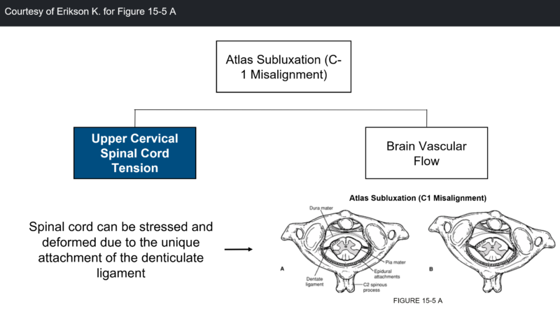 How the Atlas Misalignment Influences the Nervous System