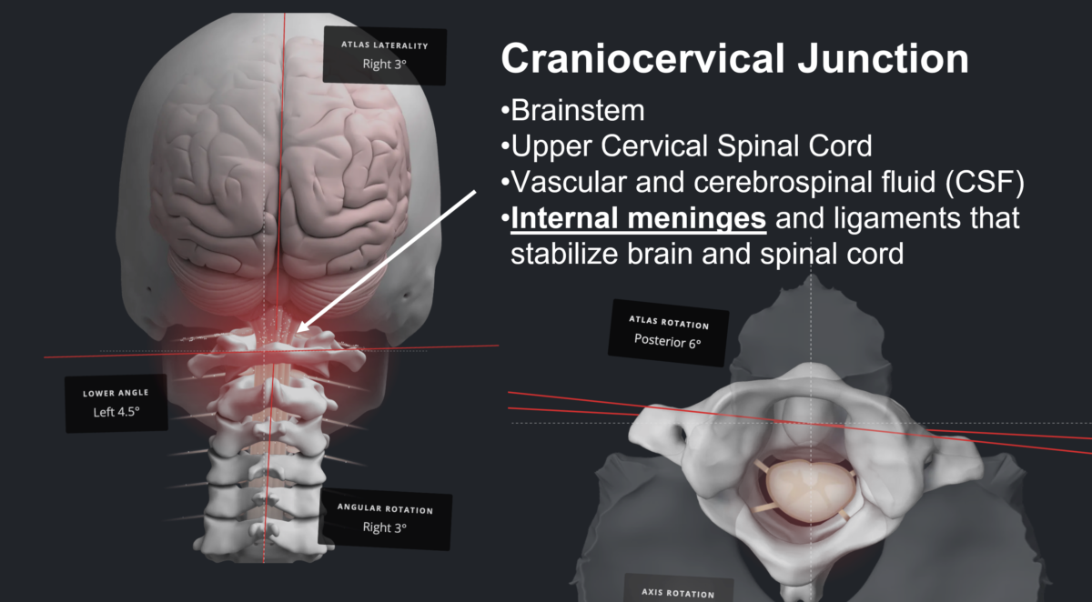 How the Atlas Misalignment Influences the Nervous System