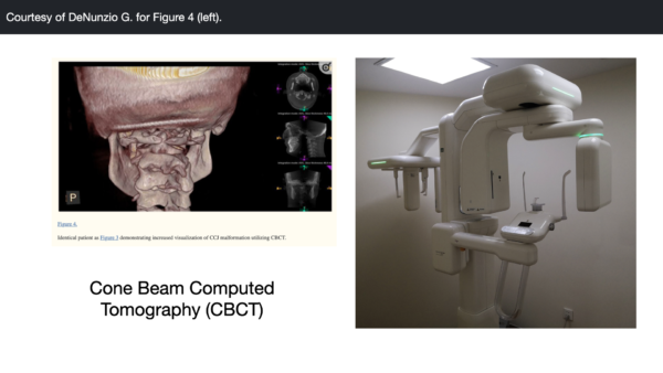 How the Atlas Misalignment Influences the Nervous System
